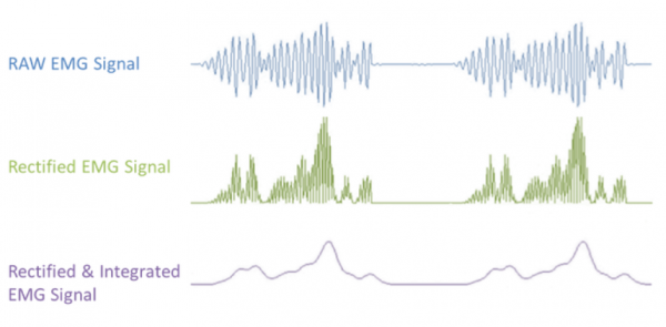 Muscle sensors-Harness the power of muscle signals - Pantech.AI