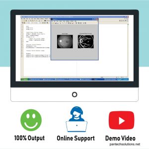 Blood Vessel segmentation in Retinal Images using Matlab