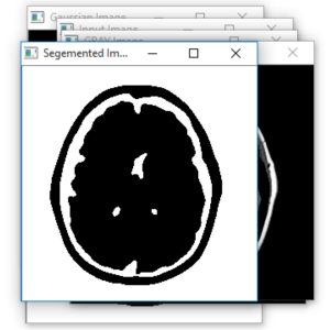 Brain Tumor Segmentation Using Neural Networks