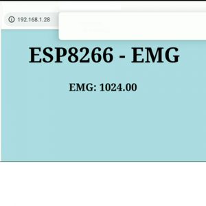 IoT Based EMG Monitoring system using Node Mcu