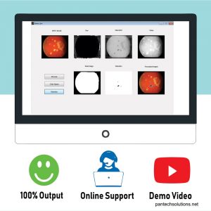 license plate recognition using fast RCNN and OCR