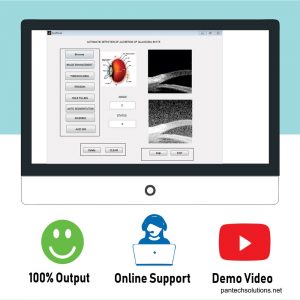 Moving object detection and tracking using SIFT with k-means clustering