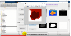 Skin Disease detection using Matlab