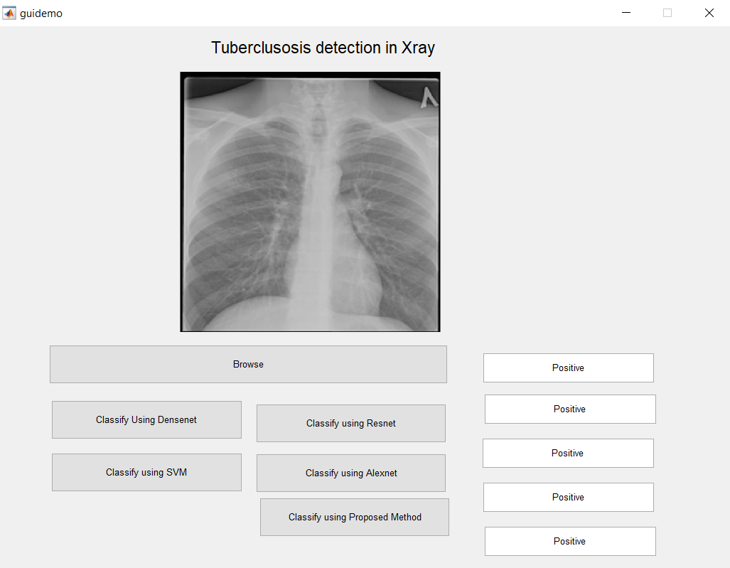 Top Image Processing Projects using Matlab- 2022 - Pantech.AI